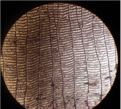 Koi Anatomy – Spike Cover – SAKKS Gauteng